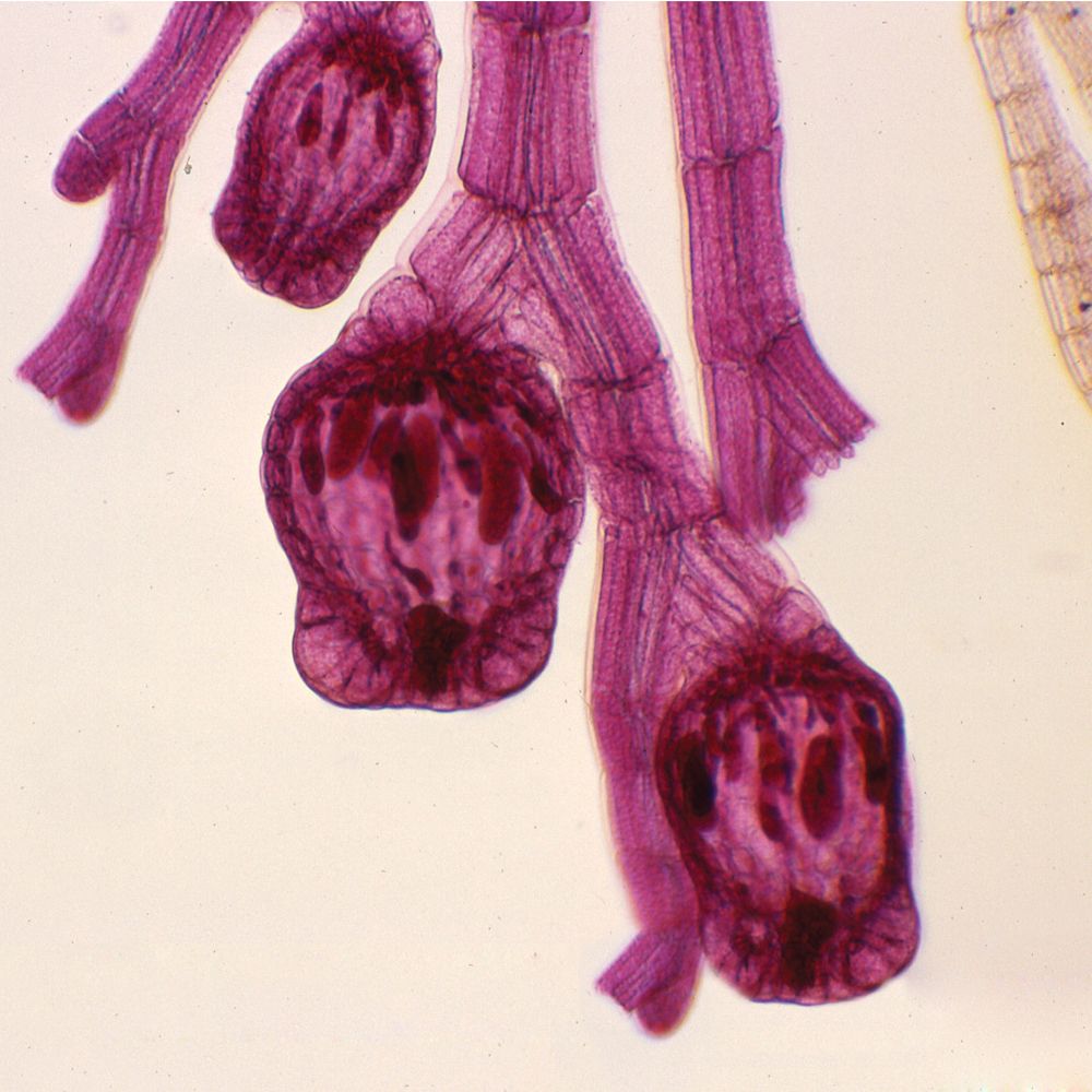 Red Algae Microscope Slides (Polysiphonia, Porphyra) | Carolina.com