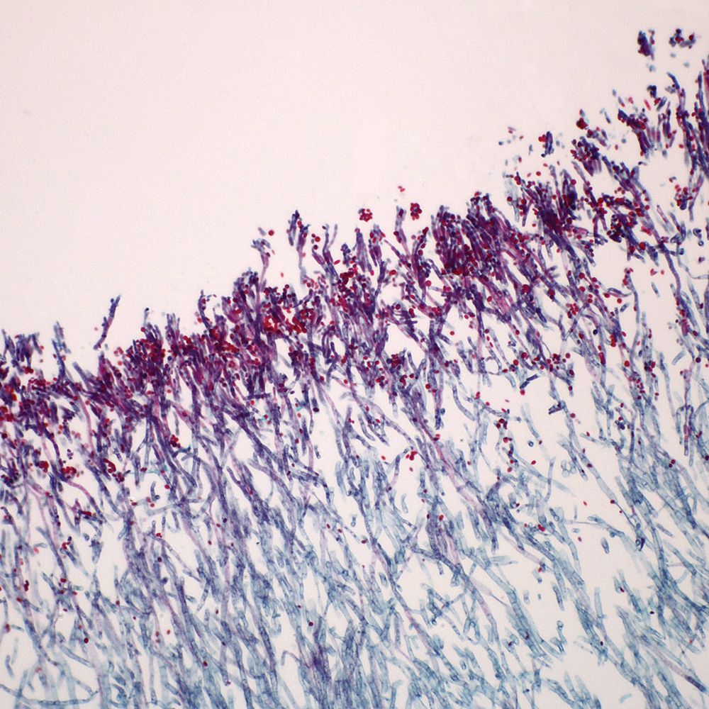 Penicillium, sec., 12 µm Microscope Slide | Carolina.com