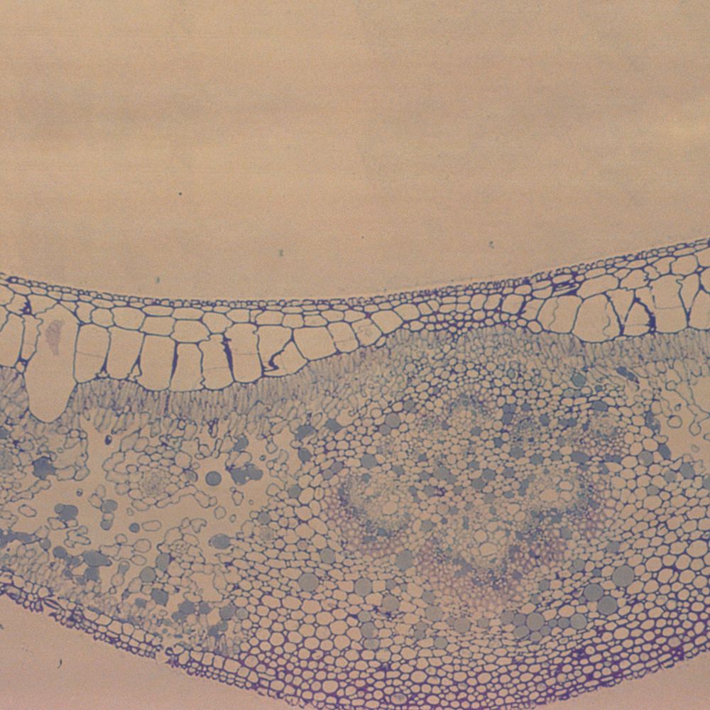 Rubber Tree Leaf, c.s., 12 µm Microscope Slide | Carolina.com