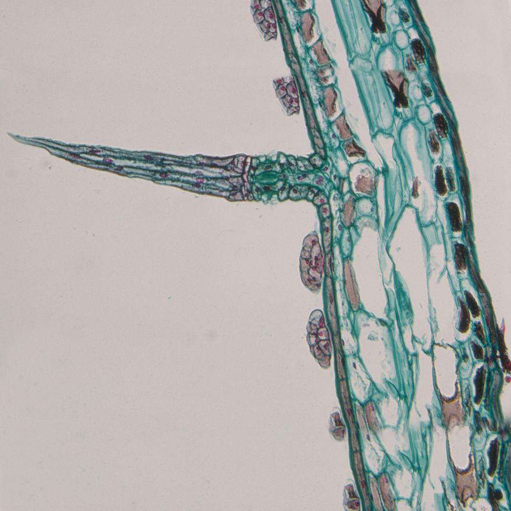 Venus Flytrap Leaf (Dionaea), c.s., Microscope Slide | Carolina.com