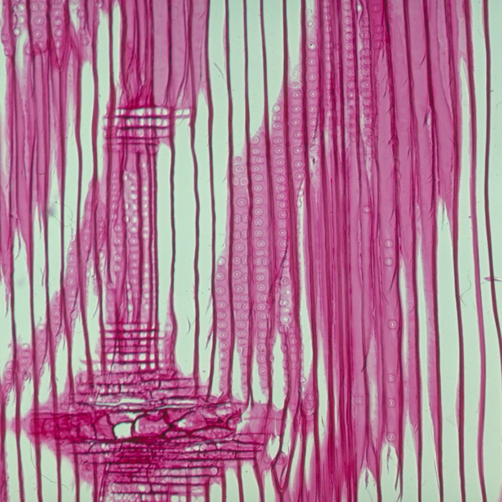 Wood Cells (Xylem) Microscope Slides, 15 µm | Carolina Biological Supply