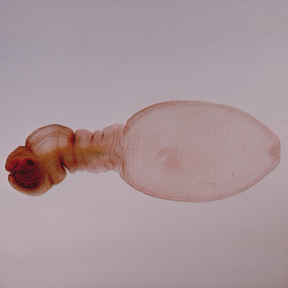 Cestodes (Tapeworms) Microscope Slides | Carolina.com