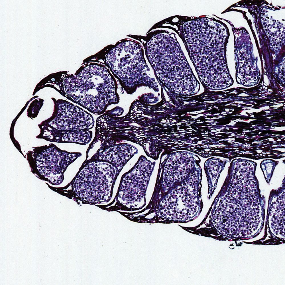 Pine Mature Staminate Cone, l.s., 12 µm Microscope Slide | Carolina ...