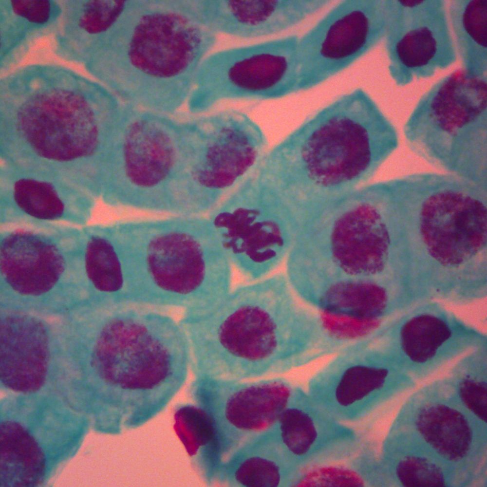 Onion Mitiosis, squash mount, Feulgen Stain Microscope Slide | Carolina ...