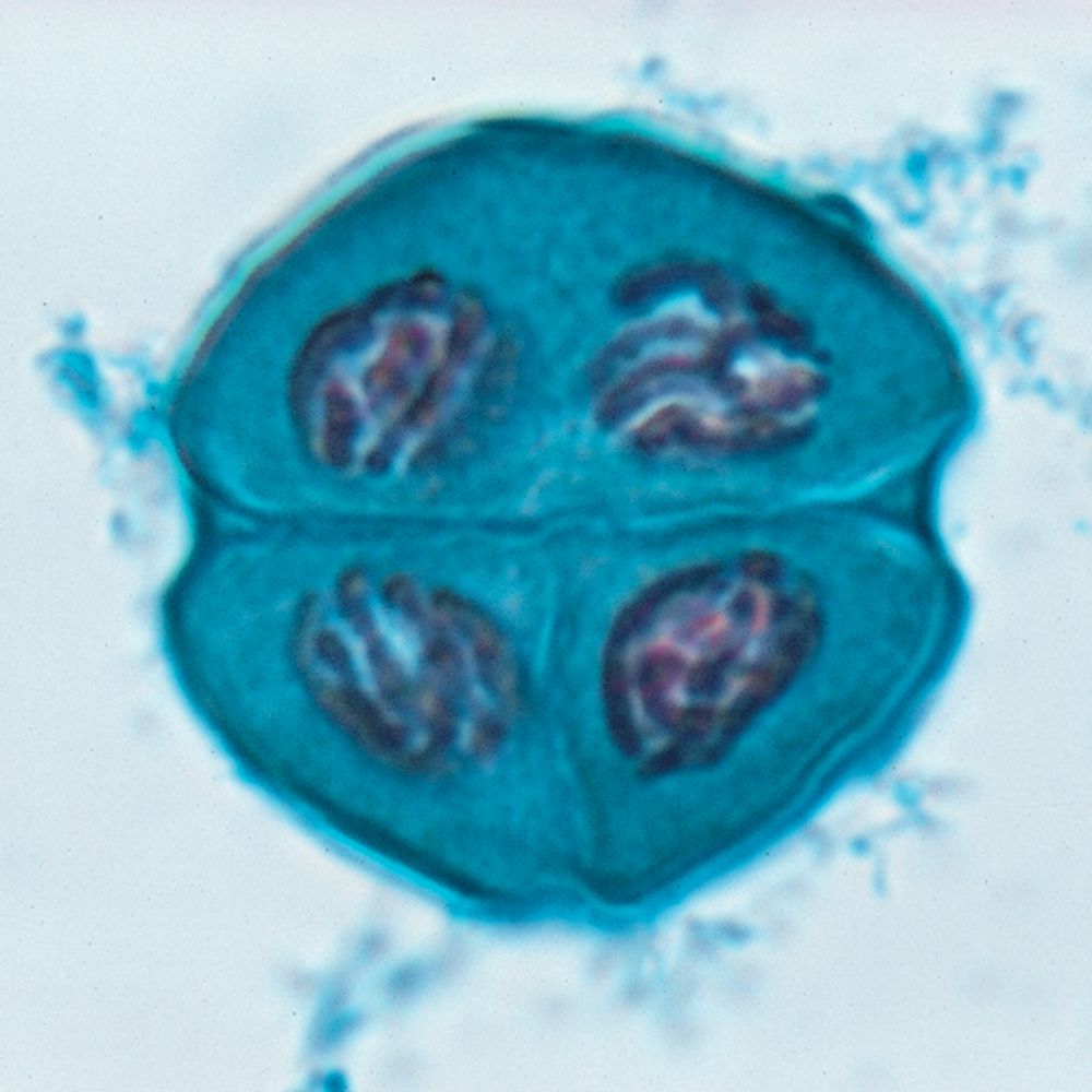 Lily Young Flower Bud, l.s., 12 µm Microscope Slide | Carolina ...