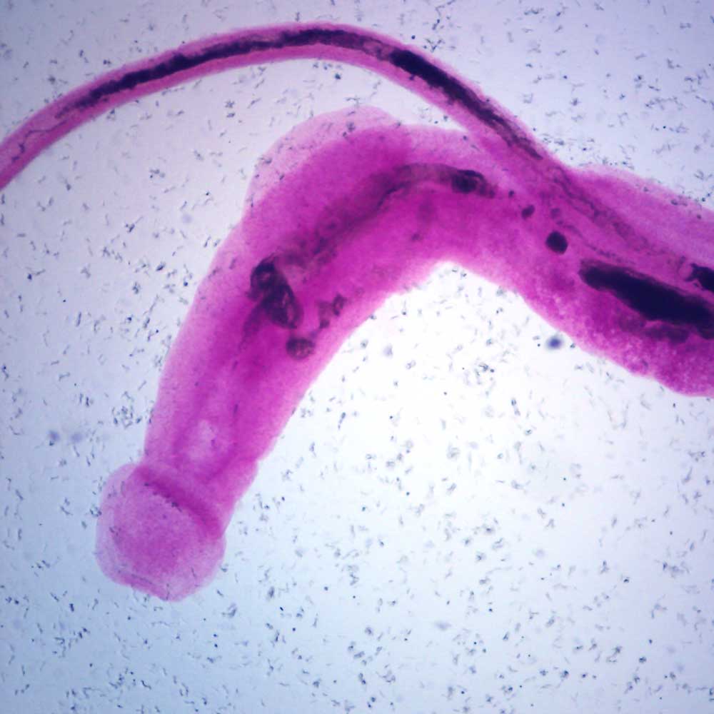 Schistosoma japonicum in Copula, w.m. Microscope Slide | Carolina.com