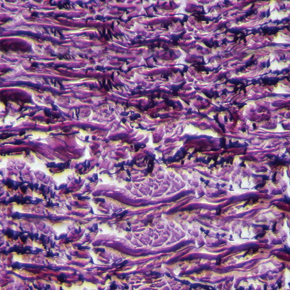 Human Elastic Tissue Slide, sec., 7 µm, Verhoeff's Stain | Carolina ...