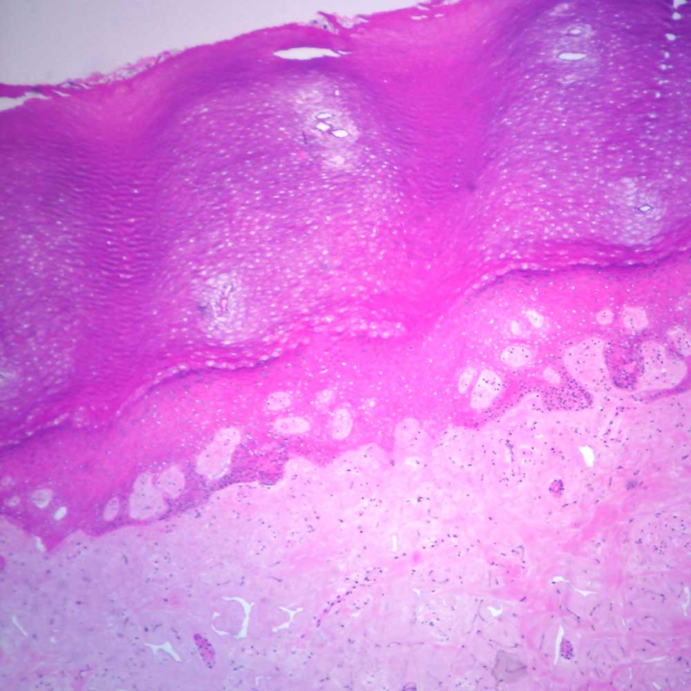 Mammal Palmar Skin Sec Thin Hande Stain Microscope Slide Carolina Biological Supply