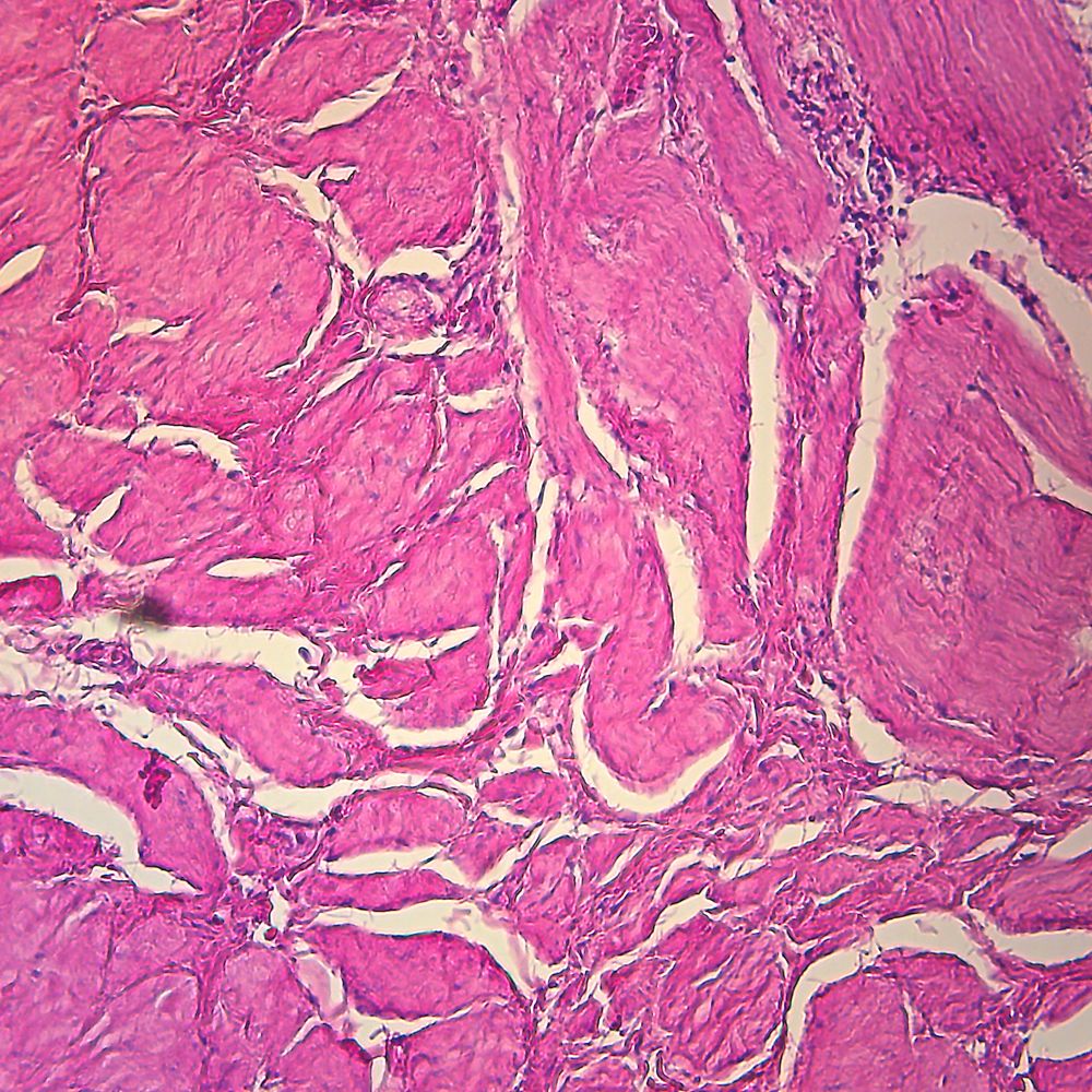 Human Pyloric Stomach, sec. 7 µm H&E Microscope Slide | Carolina.com