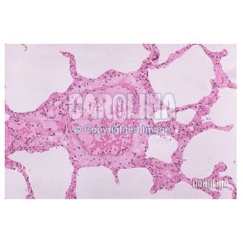 Human Lung Microscope Slides | Carolina Biological Supply