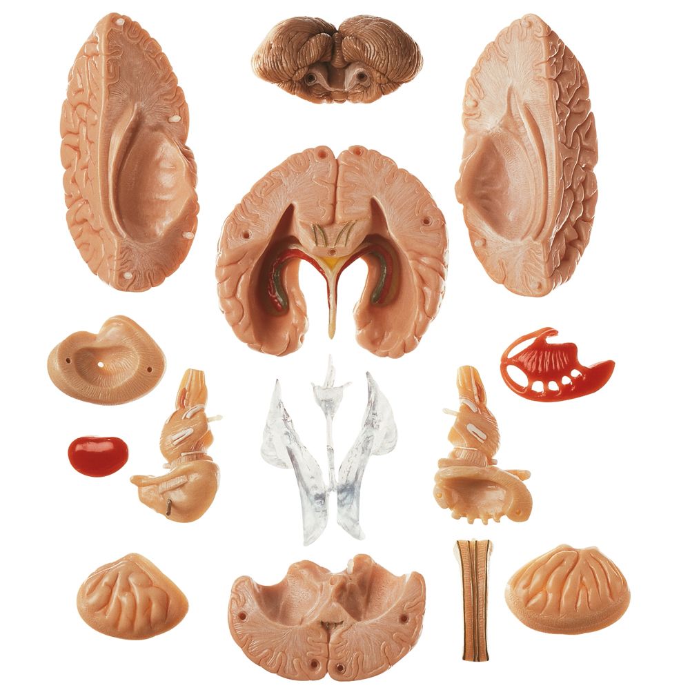 Somso® Human Brain Model, 15 Parts | Carolina Biological Supply