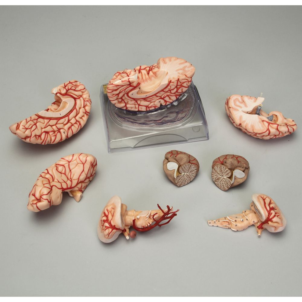 Somso Human Brain with Arteries Model | Carolina Biological Supply