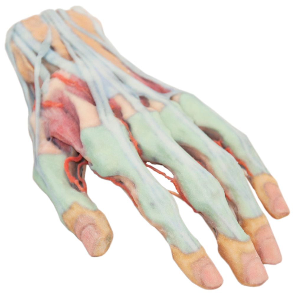 3-D Printed Human Superficial Hand Dissection Model | Carolina ...