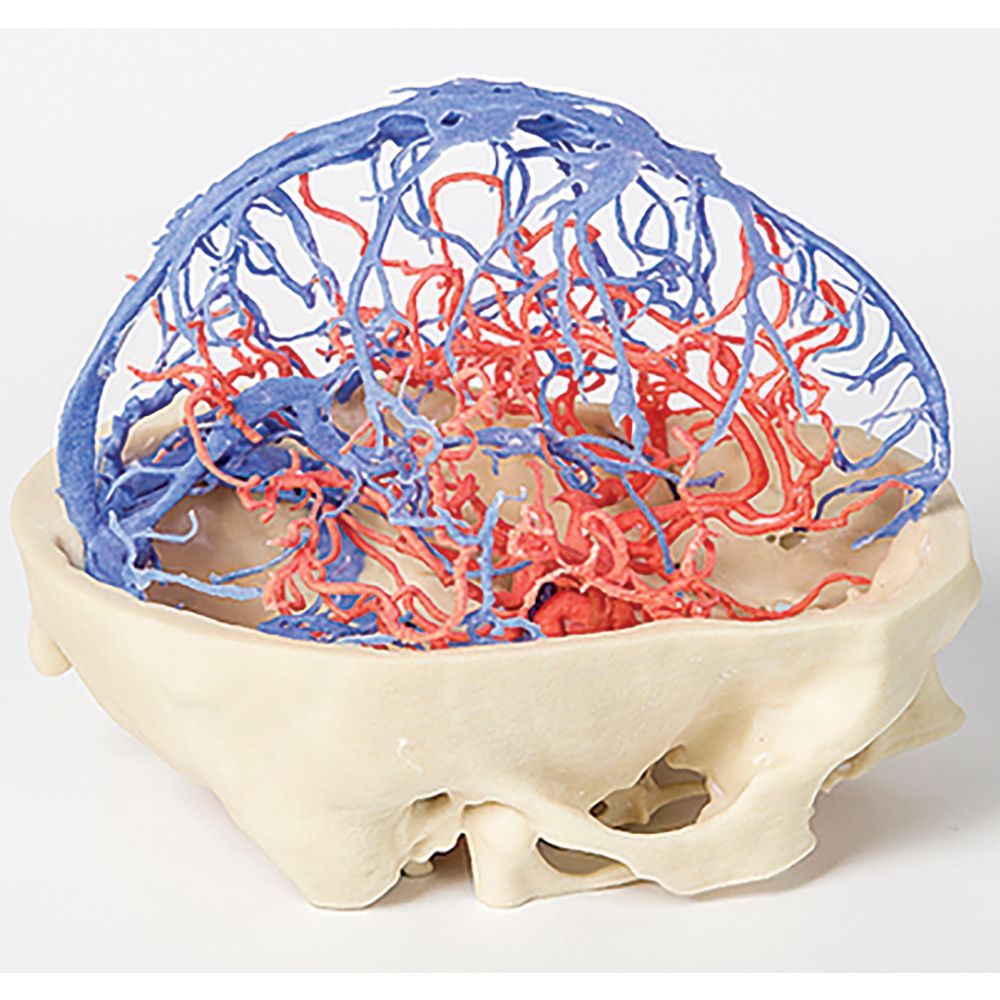 3-D Printed Human Cranial Circulation Model | Carolina Biological Supply