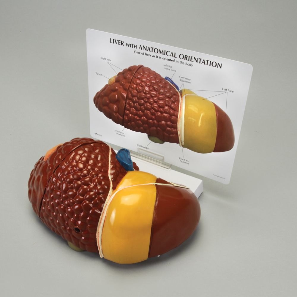 GPI Anatomicals® Human Liver Pathology Model | Carolina Biological Supply