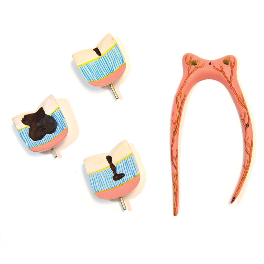 Eisco® Human Upper Triple Root Molar with Interchangeable Cavities ...