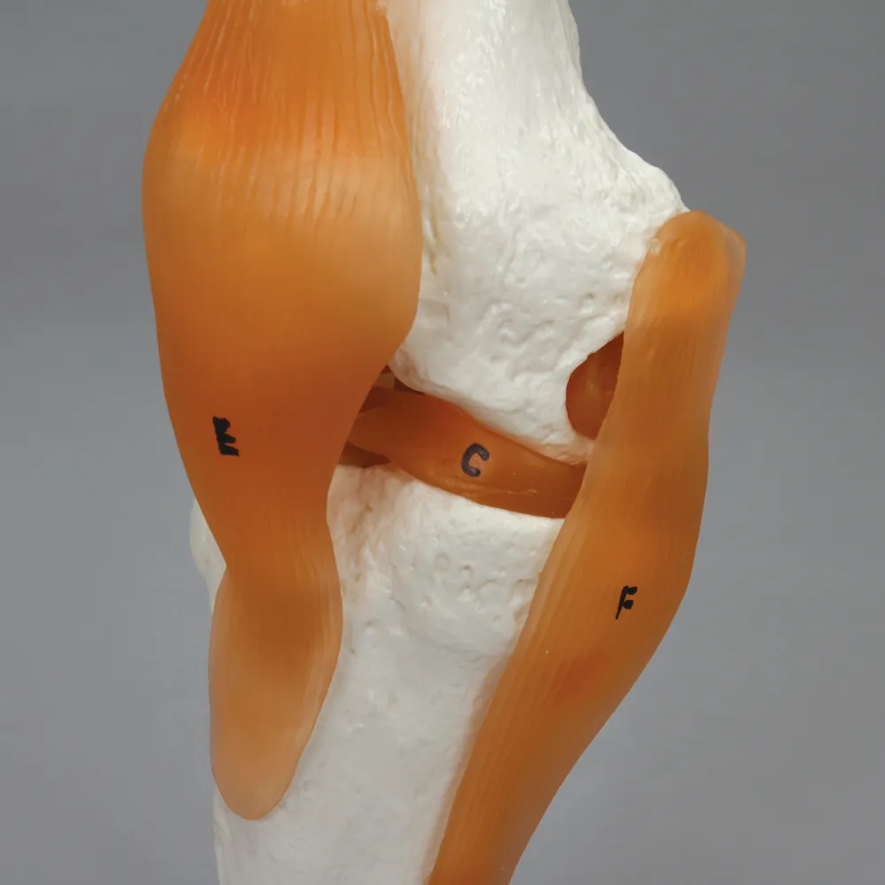Carolina® Human Knee Joint Model | Carolina Biological Supply