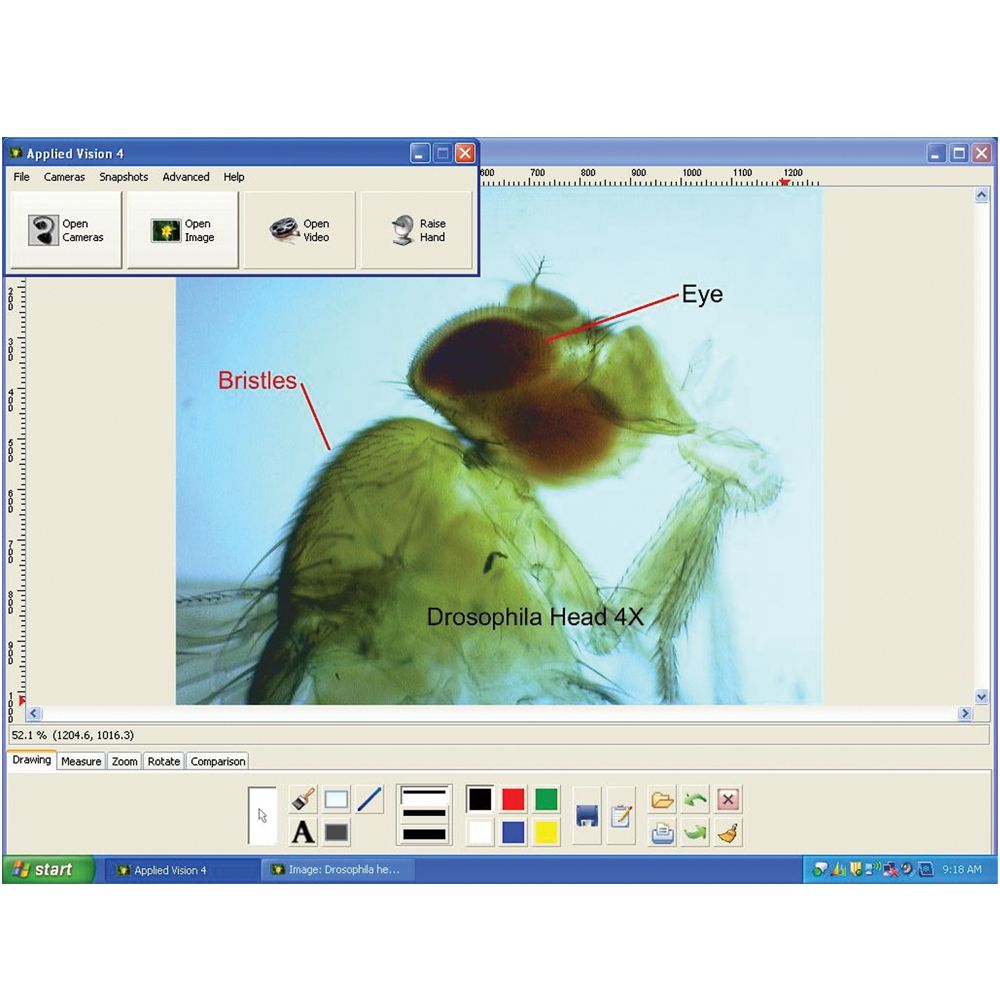 Ken-A-Vision® Megapixel PupilCAM 2.0 with 10x Eyepiece (USB) | Carolina ...