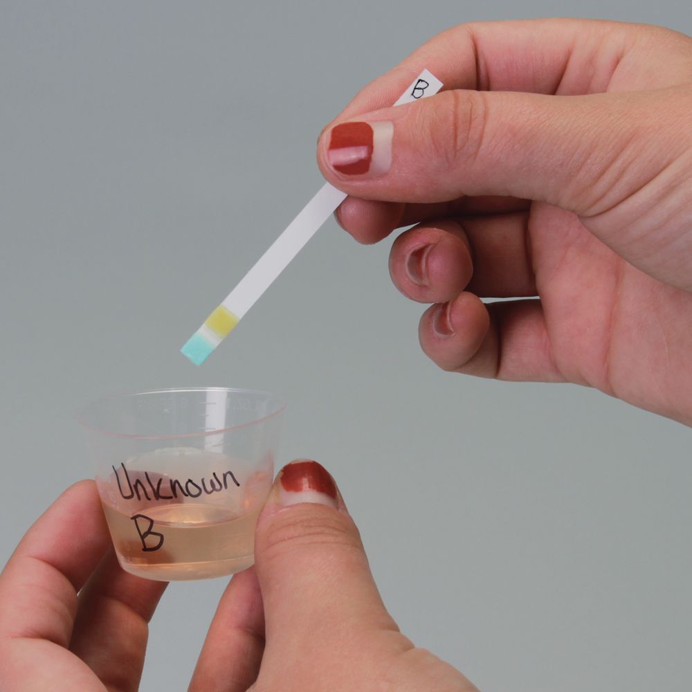 Carolina BioKits®: Urine Examination | Carolina Biological Supply