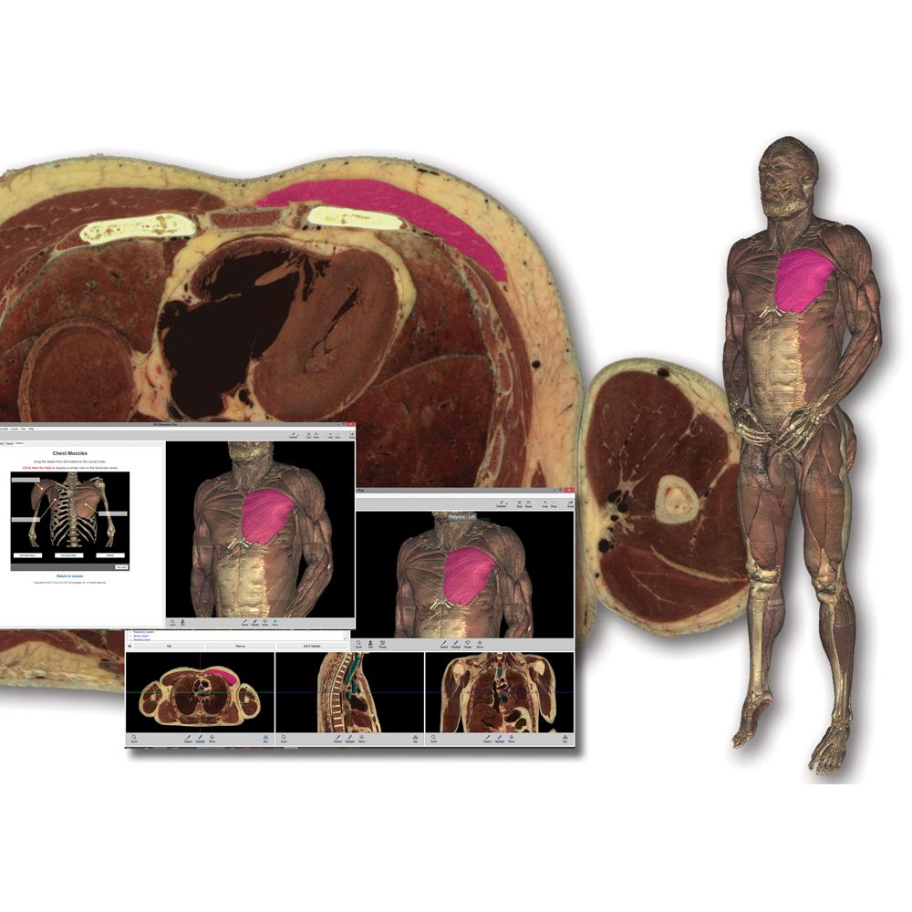 VH Dissector Anatomy Software | Carolina Biological Supply