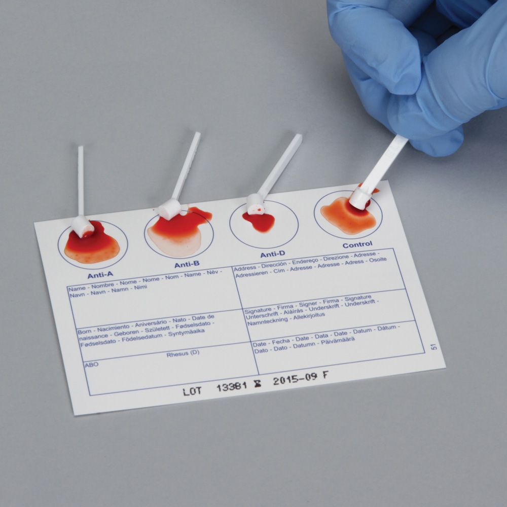 Blood Typing Lab