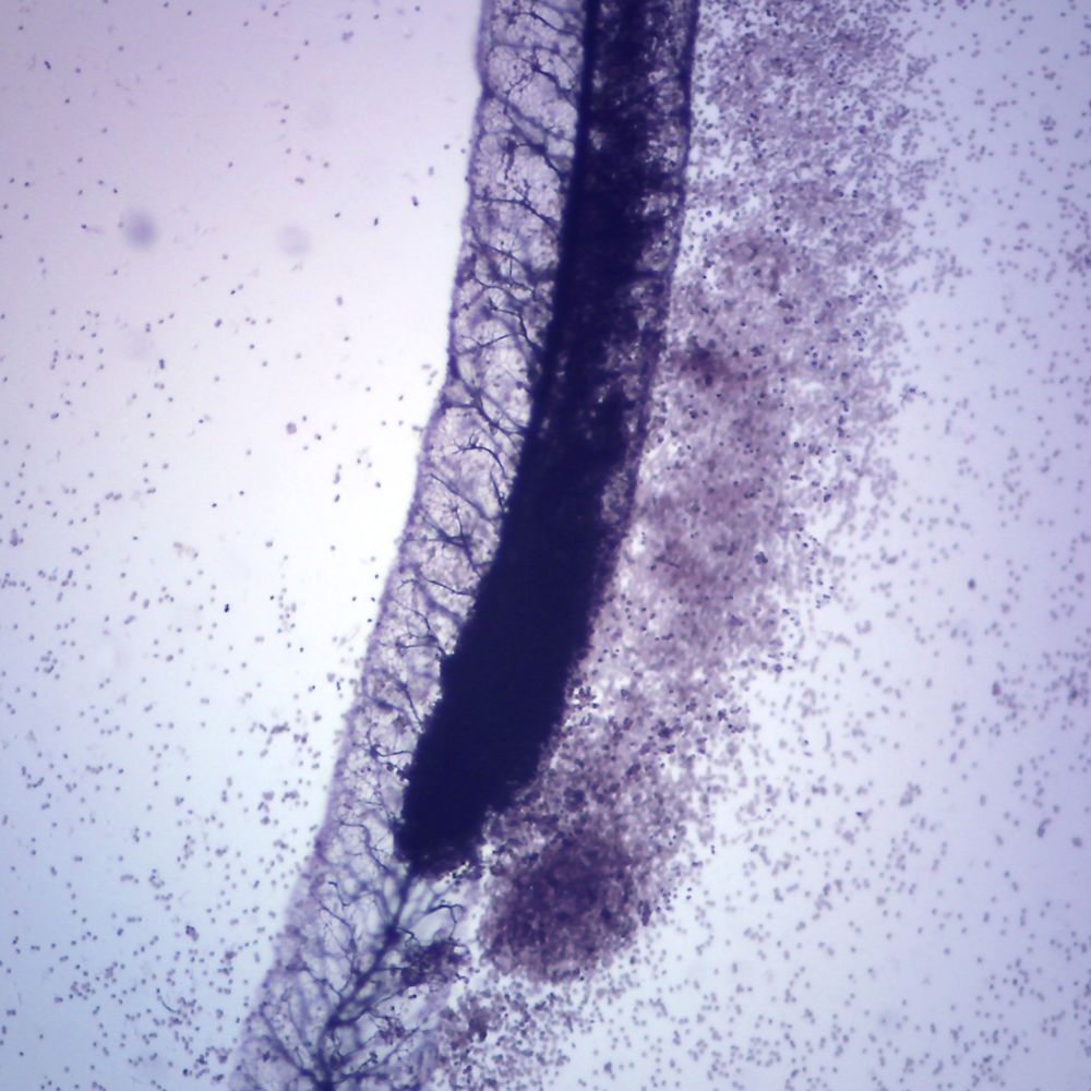 Stemonitis, w.m., Microscope Slide | Carolina Biological Supply