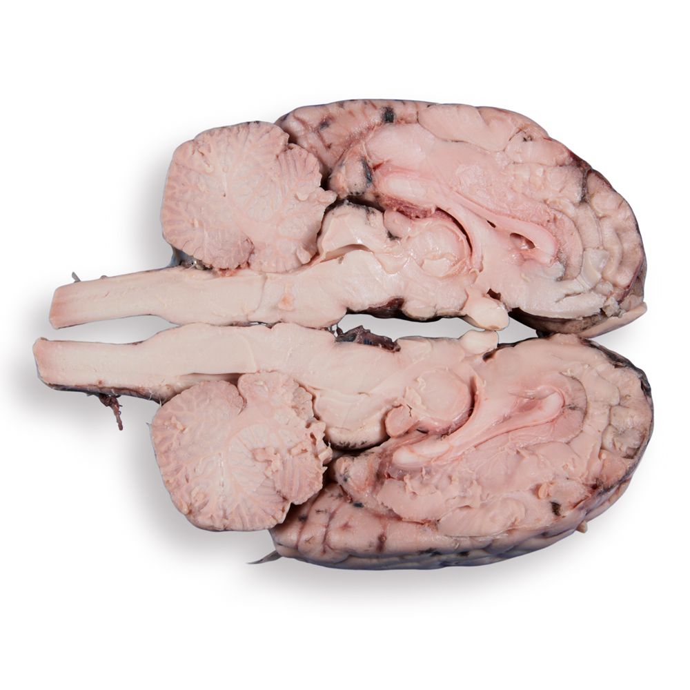 Carolina's Perfect Solution® Preserved Sheep Brains | Carolina ...