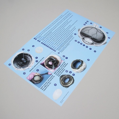 Elementary Dissection Mat, Carolina® Cow Eye | Carolina Biological Supply