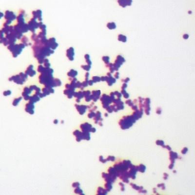 Mixed Gram-Positive & Gram-Negative Coccus, w.m. Gram Stain Microscope ...