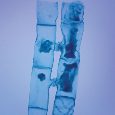Spirogyra Scalariform Conjugation, Vegetative and Zygote Stages, w.m ...