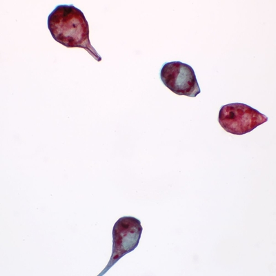 Stentor Slide, w.m. | Carolina Biological Supply