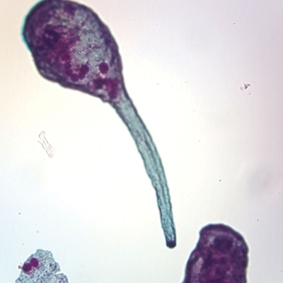 Stentor Slide, w.m. | Carolina Biological Supply