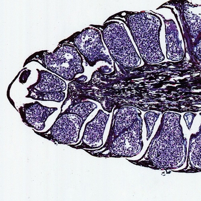 Pine Mature Staminate Cone, l.s., 12 µm Microscope Slide | Carolina ...