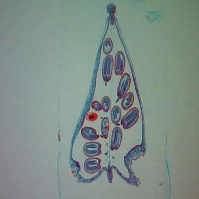 Shepherd's Purse (Capsella) Mature Embryo, l.s., 12 µm Microscope Slide ...