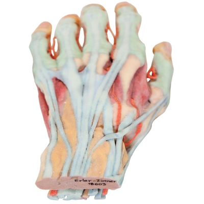 3-D Printed Human Superficial Hand Dissection Model | Carolina ...