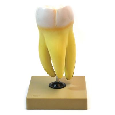 Eisco® Human Upper Triple Root Molar with Interchangeable Cavities ...