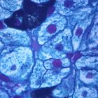 Mitosis & Meiosis Microscope Slides | Carolina.com