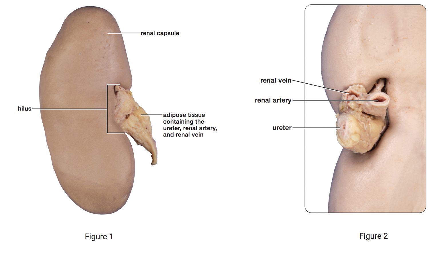 14 Kidney Dissection Labelled DhanikaNellija
