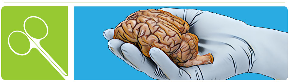 Sheep Brain Dissection Carolina