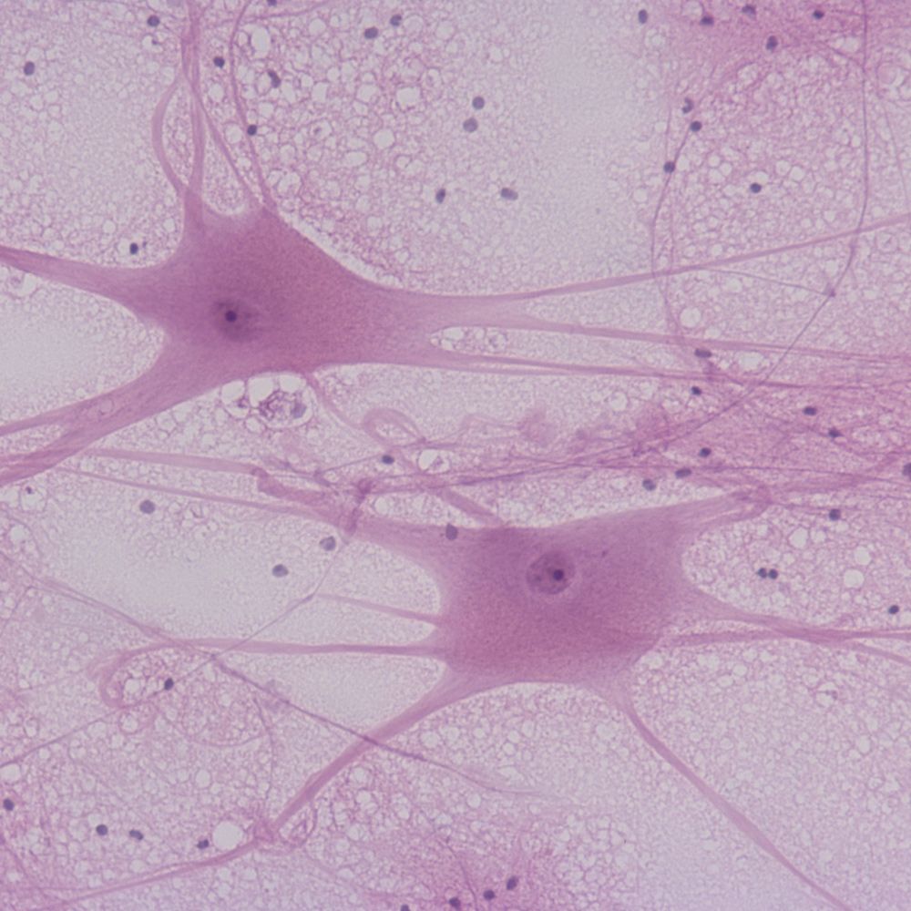 A Brief Look at Cells: Shape and Function | Carolina.com